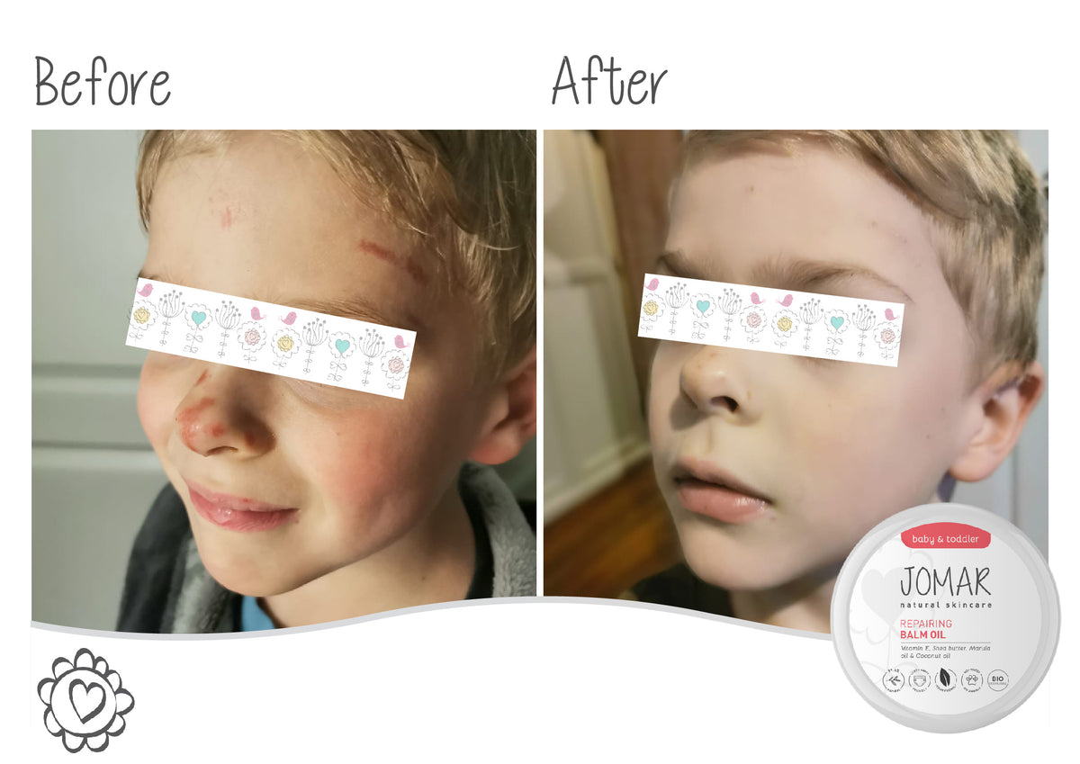 Repairing Balm Oil | Soothe, Repair, and Soften Skin – JOMAR Natural ...